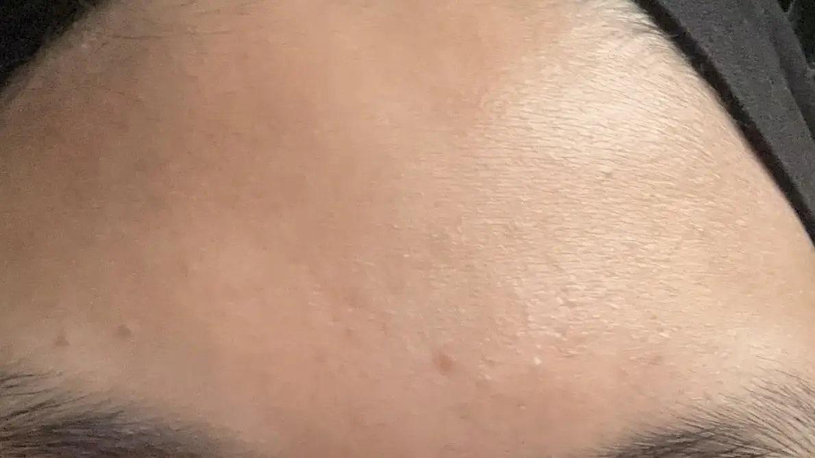 REFY Face Sculpt VS Blume Meltdown Gel Cream for Acne-Prone Skin